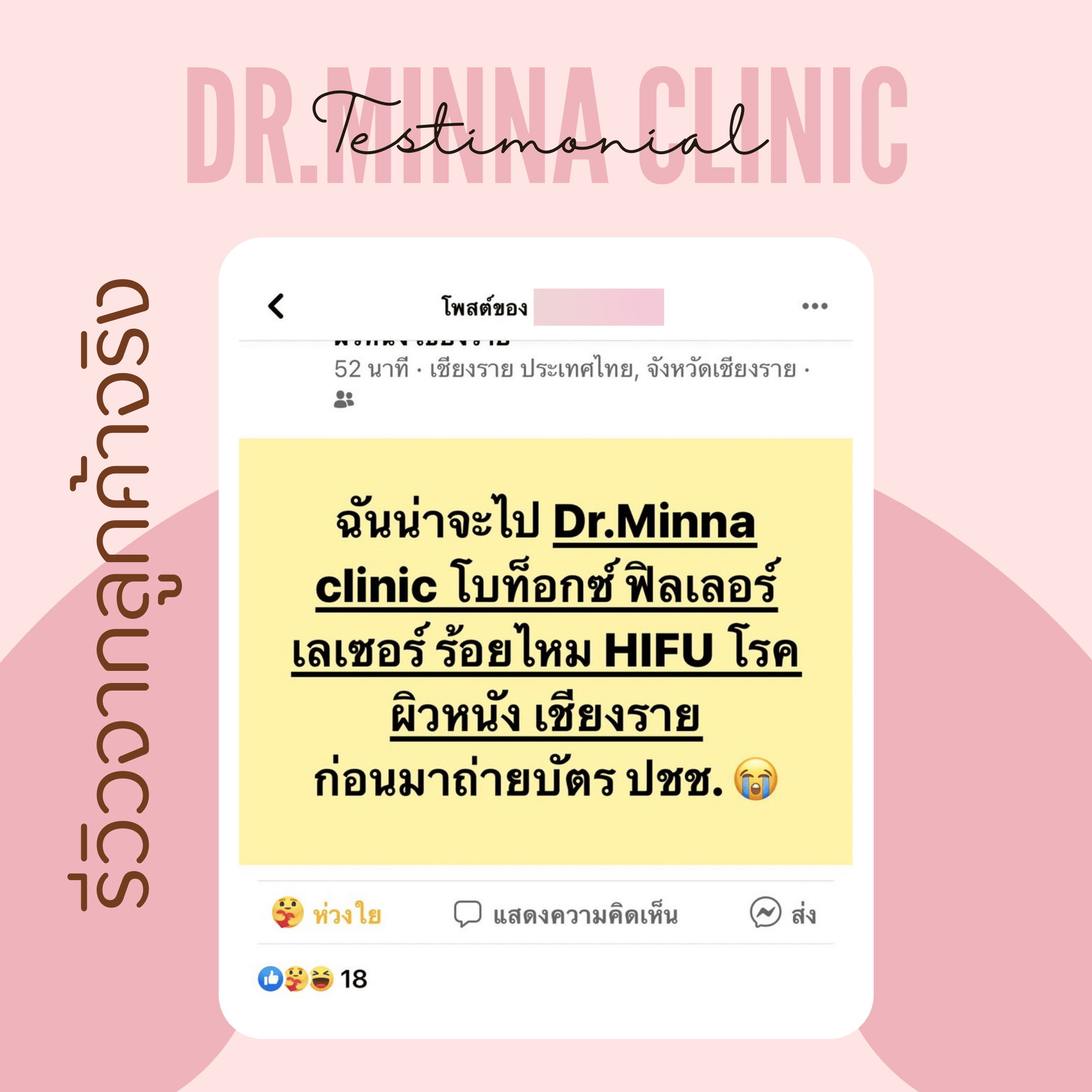 เลเซอร์คาร์บอนไดออกไซด์ (CO2 laser) – DR.MINNA CLINIC